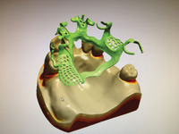 Cobalt Chrome Castings - Dentacast
